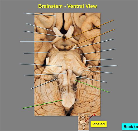 Brainstem Ventral View Diagram Quizlet