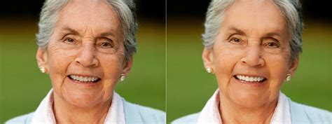 photos retouchées avant après Recherche Google Отбеливание зубов