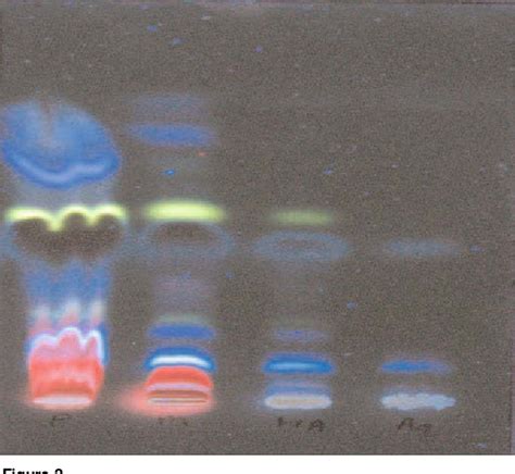 figure 2 from development and validation of hptlc method for simultaneous determination of
