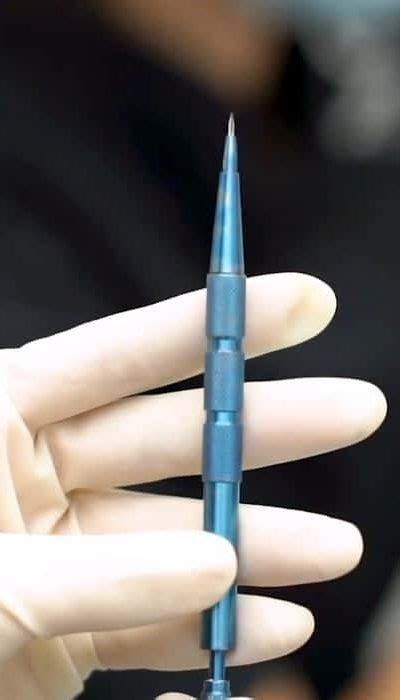 Hair Transplant Cost Roots Hair Success Rate Healing Process Latest