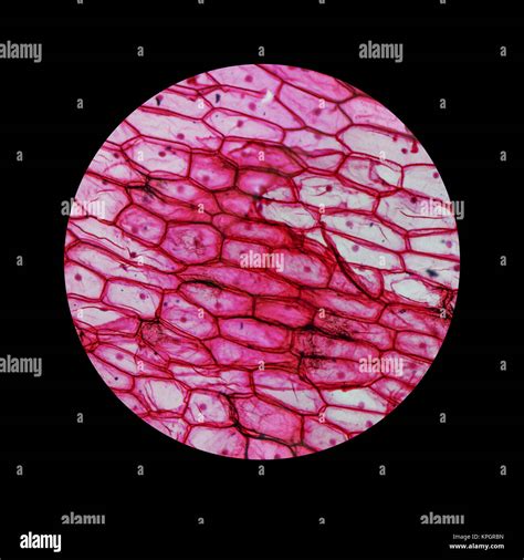 Labeled Onion Cell Under Microscope 40x Micropedia