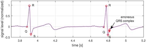 ecg based biometric authentication