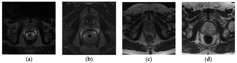 applied sciences free full text cda net for automatic prostate segmentation in mr images