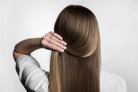 Alopecia Por Tracci N Qu Es La Alopecia Traccional