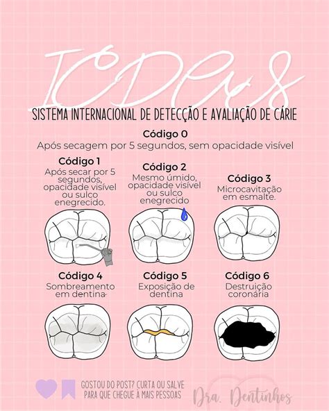Dra Dentinhos Alice On Instagram ICDAS O ICDAS Sistema
