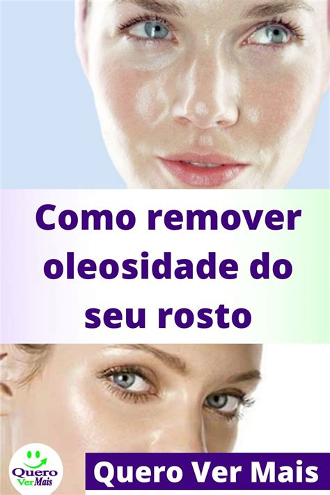 Como Remover Oleosidade Do Seu Rosto Quero Ver Mais