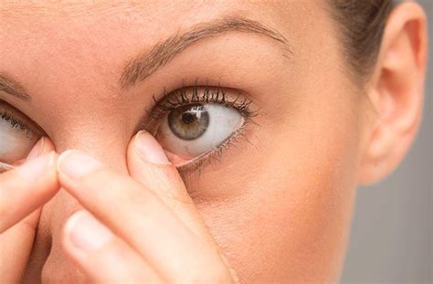 Remela como são formadas Causas de acúmulo nos olhos Arquiteta Giovanna