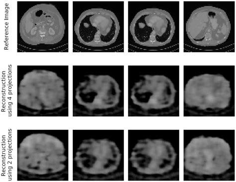 example of sparse view reconstruction using automap trained on ct images download scientific