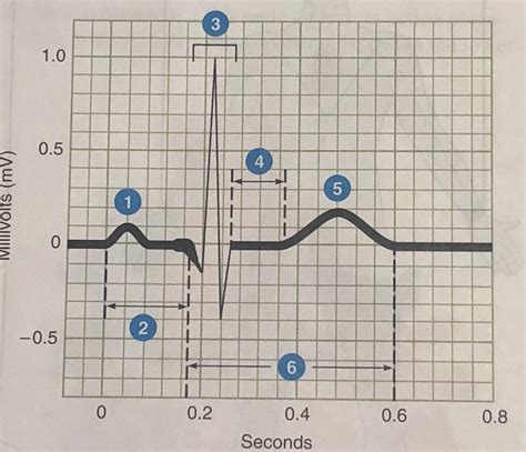 Sections Of A Normal Ecg Lead Ii Diagram Quizlet