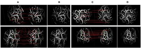 scale invariant feature transform sift feature and matching the left download scientific
