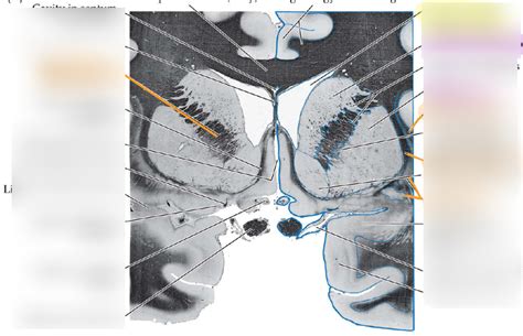 Brain Coronal View Diagram Quizlet