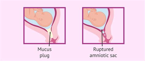 What Does The Mucus Plug Look Like Prenatal Vitamins