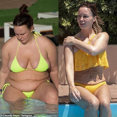 Chanelle Hayes muestra su increíble figura y revela nueva cicatriz de
