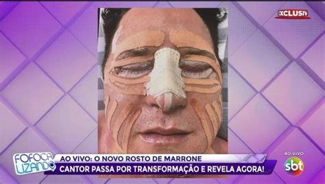 Fofocalizando Mostra Antes E Depois Chocante De Marrone