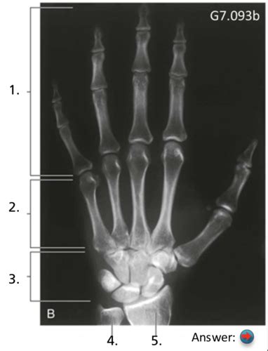 Finger Hand Wrist Forearm Positioning Flashcards Quizlet
