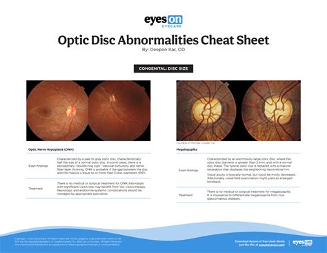 Optic Disc Abnormalities Cheat Sheet Exam Findings Characterized By A