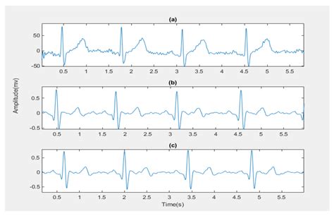 diagnostics free full text advanced time frequency methods for ecg waves recognition