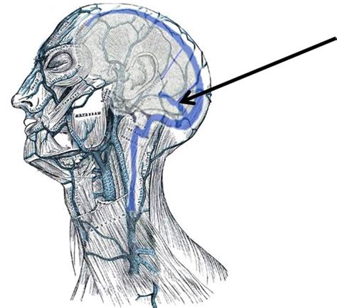 Neurology Lab 1 Picture Quiz Flashcards Quizlet