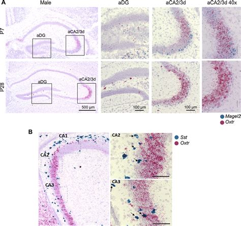 Expression Of Magel2 And Oxytocin Receptor Oxtr Transcripts In