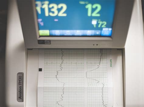 What You Need To Know About EKG Technician Certification