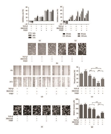 YHJD Inhibited Gastric Cancer MGC 803 Cells Proliferation Adhesion