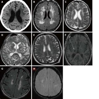 Computed Tomography And Magnetic Resonance Imaging Images Demonstrating