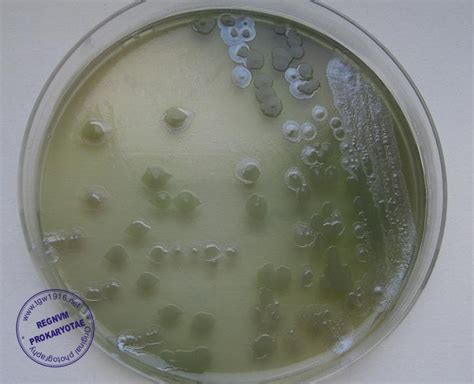 Pseudomonas Aeruginosa Colony Morphology