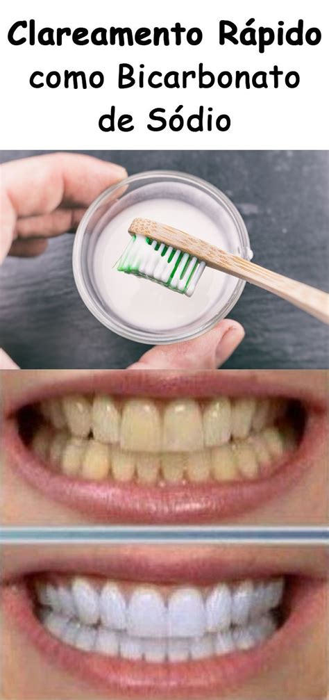 Clareamento dental caseiro Bicarbonato de sódio CONHECENDO IDEIAS