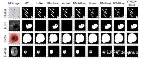 bt unet 生物医学图像分割的自监督学习框架 知乎