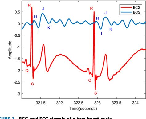 figure 1 from motion artifact detection and reduction in bed based ballistocardiogram semantic