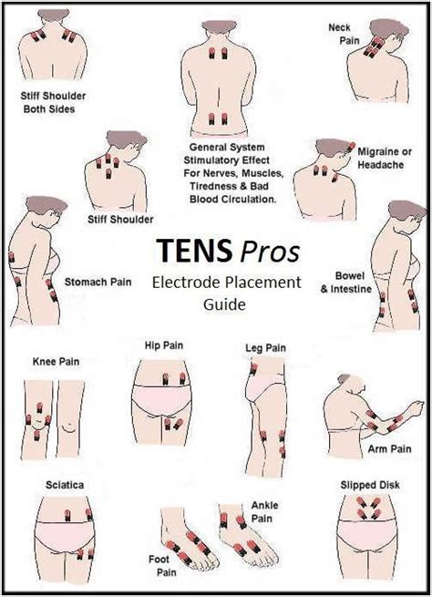 electrode placement for electrical stimulation chart