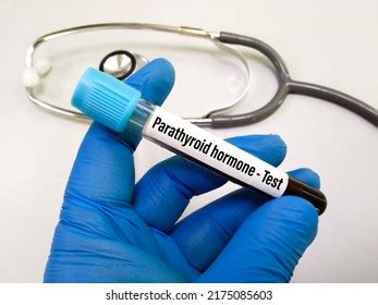 Test Tube Blood Sample Parathyroid Hormone Stock Photo 2175085603