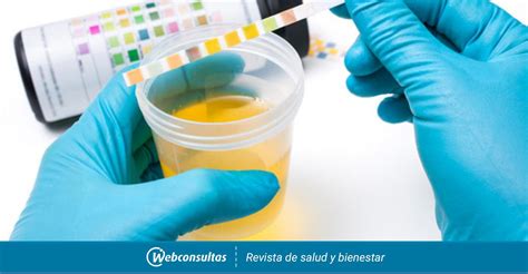 Diagn Stico De Una Infecci N Urinaria