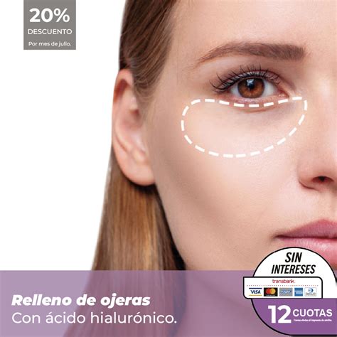 Relleno de ojeras con acido hialurónico Clínica SMER Cirugías