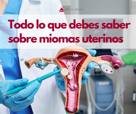 Miomas Uterinos Sintomas Y Consecuencias Infoupdate Org