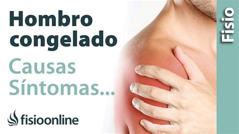 Causas síntomas y tratamiento del hombro congelado FisioOnline