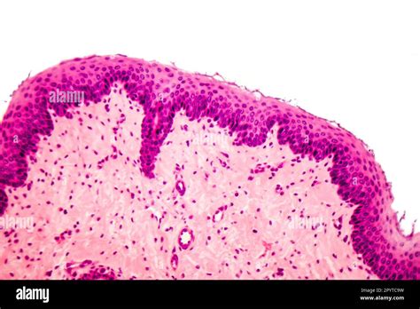 Stratified Squamous Epithelium Under Microscope Porn Sex Picture
