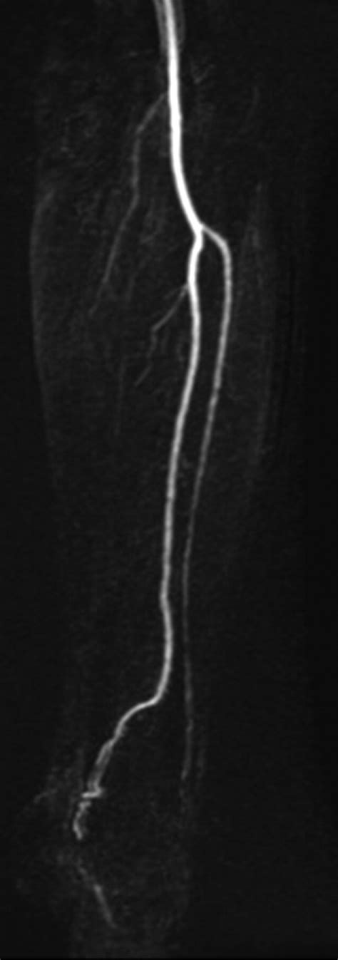 Applications Of Time Resolved MR Angiography AJR