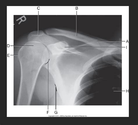 Shoulder Diagram Quizlet