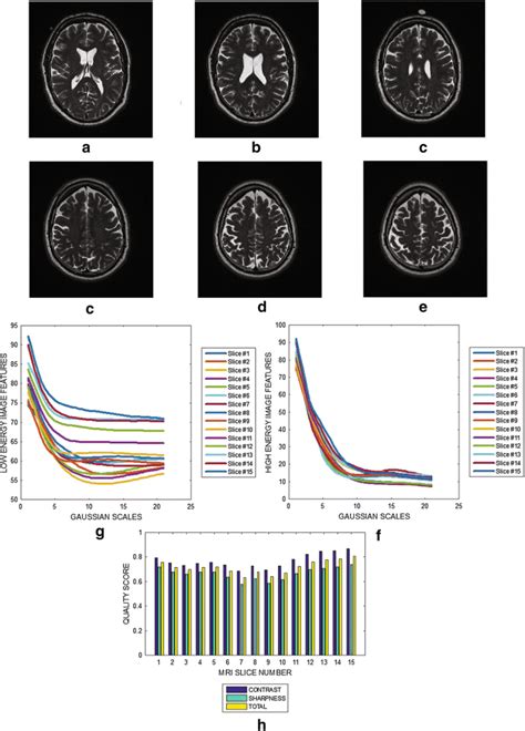 blind blur assessment of mri images using parallel multiscale difference of gaussian filters