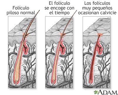 Fol Culo Piloso Medlineplus Enciclopedia M Dica Illustraci N