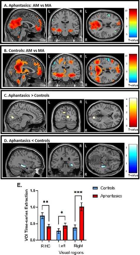 Figures And Data In Hippocampal Occipital Connectivity Reflects