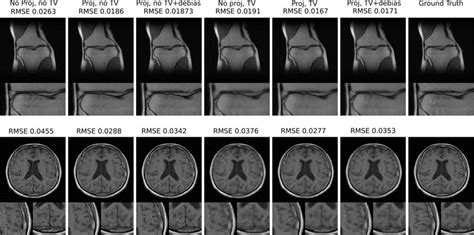 comparison of images reconstructed by use of various regularization download scientific diagram