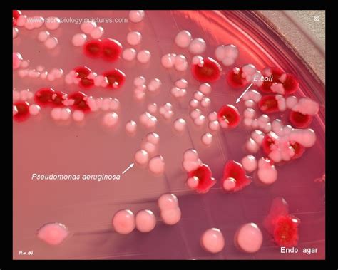 Pseudomonas Aeruginosa Lactose Negative Colonies On Endo Agar Colony