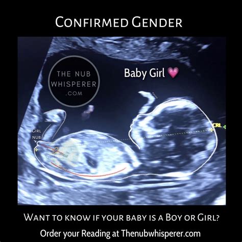 Pin By The Nub Whisperer Specialist On Gender Prediction In 2020