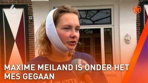 DIT Heeft MAXIME MEILAND Aan Zichzelf LATEN DOEN SHOWNIEUWS YouTube