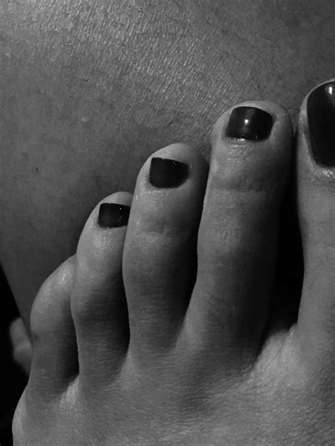 White Skin Between Toes Lupon Gov Ph