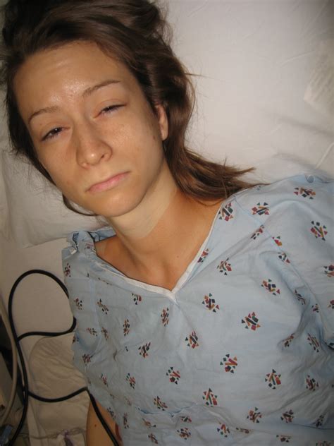 Prophylactic Bilateral Mastectomy Reconstruction The Past Weeks