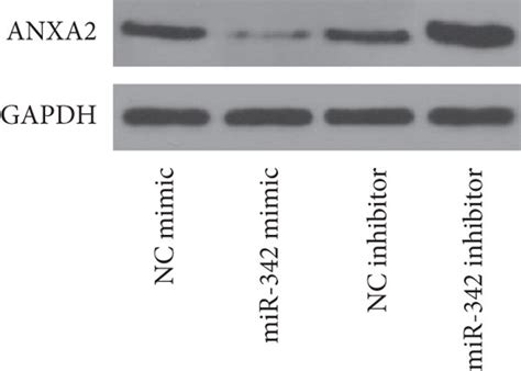 MiR 342 Targets And Inhibits ANXA2 Expression A The Binding Sites