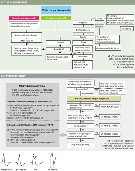 Ventricular Tachycardia Causes Diagnosis And Treatment